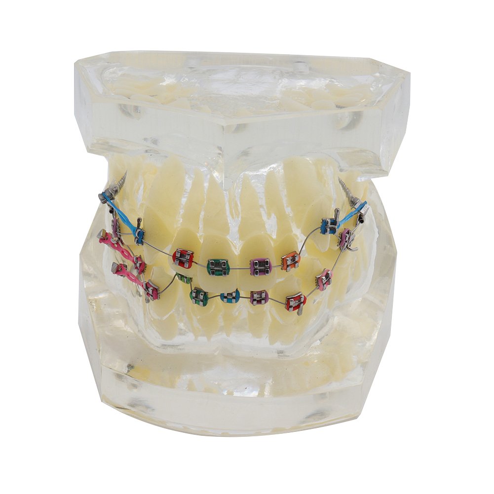 Orthodontic Study Model – Javed Dental Supply